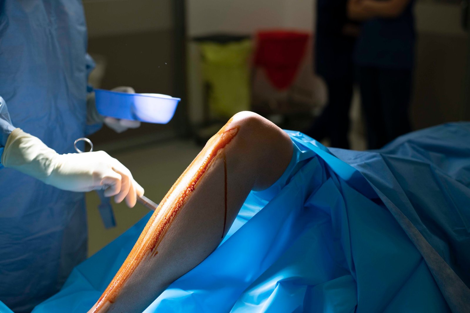 5 Signs It's Time to Consider Knee Replacement Surgery - Dr Darren Paterson